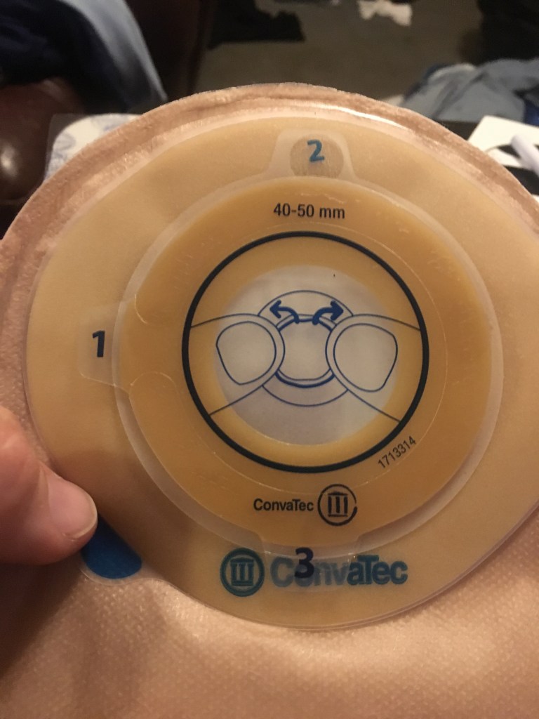 A bonsai, an ostomy, a life – Adam's Art and Bonsai Blog